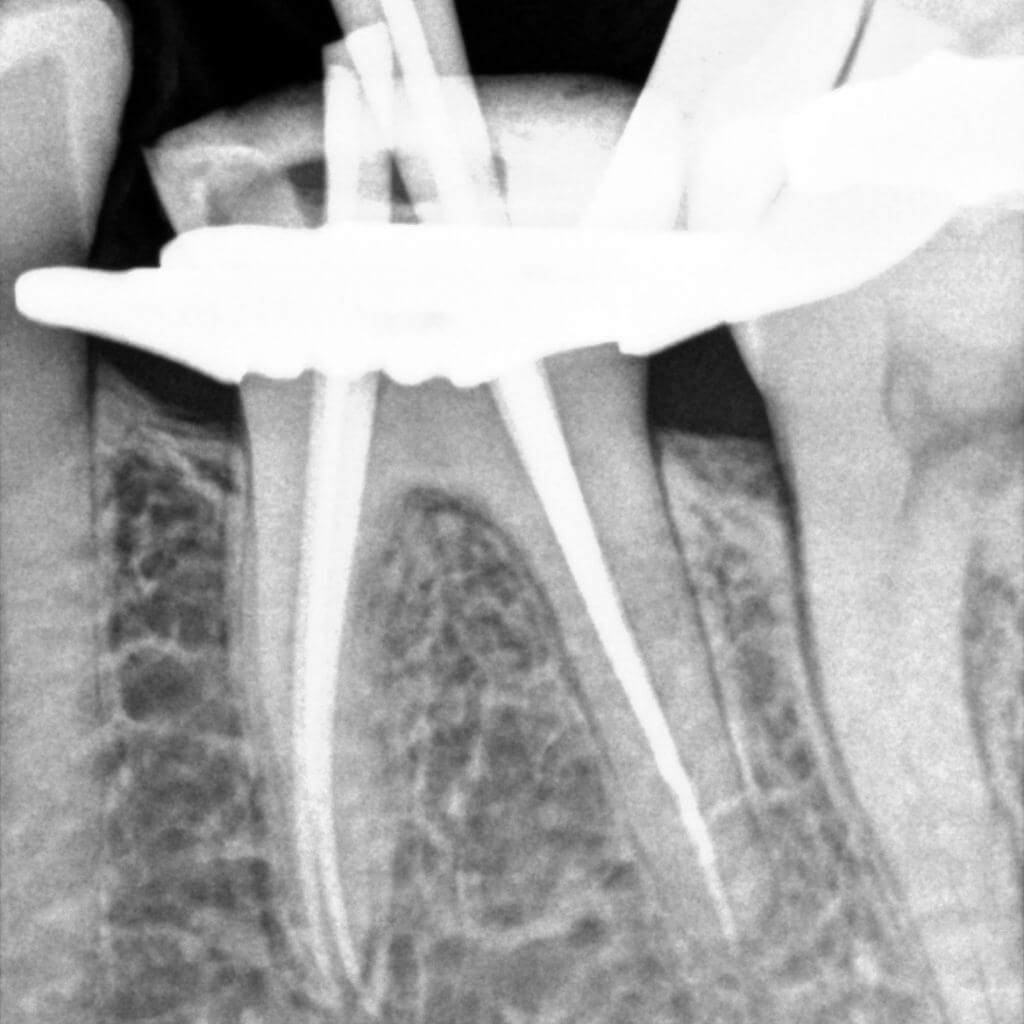 Radiovisiografo RVG Exclusive – Dental Pro