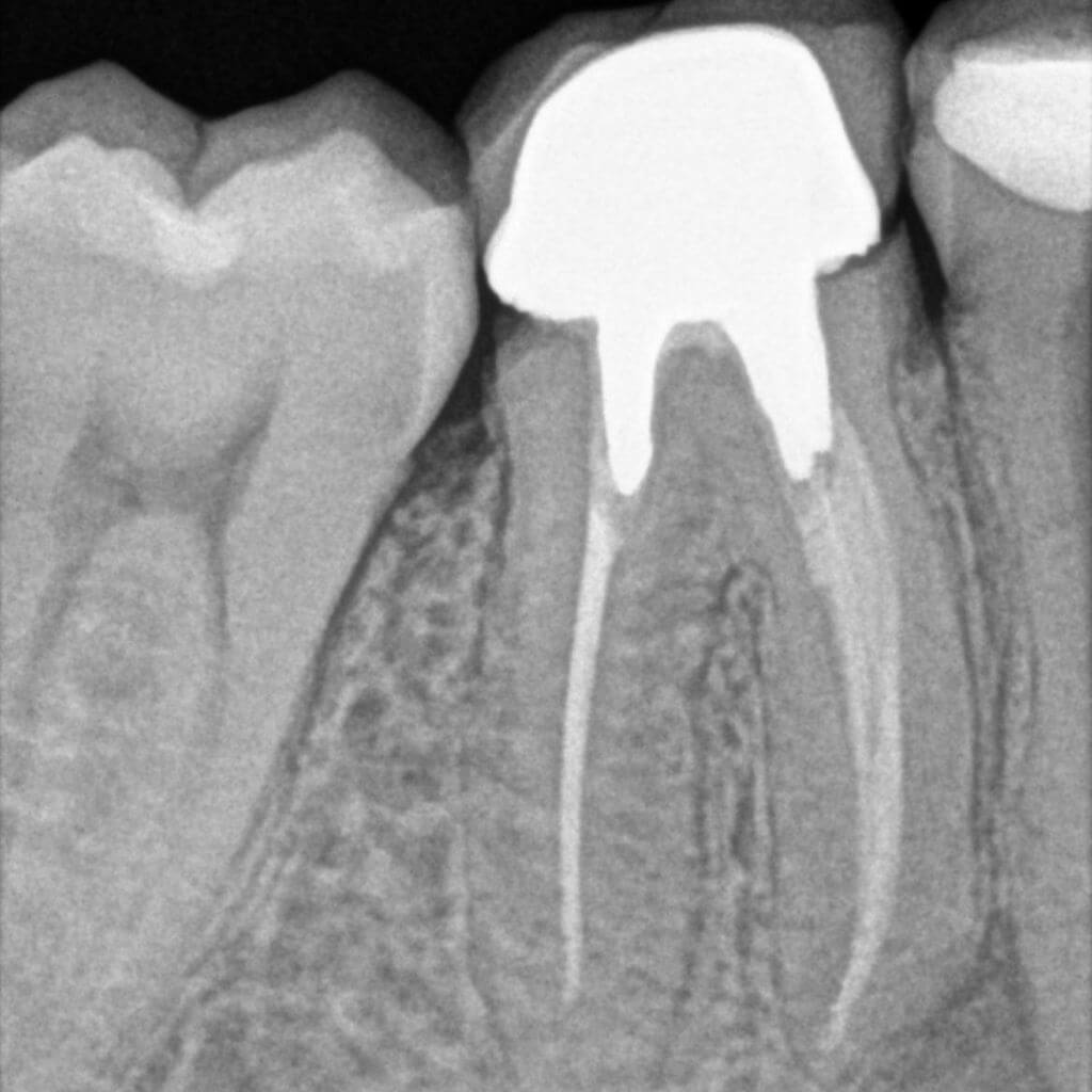 Radiovisiografo RVG Element – Dental Pro