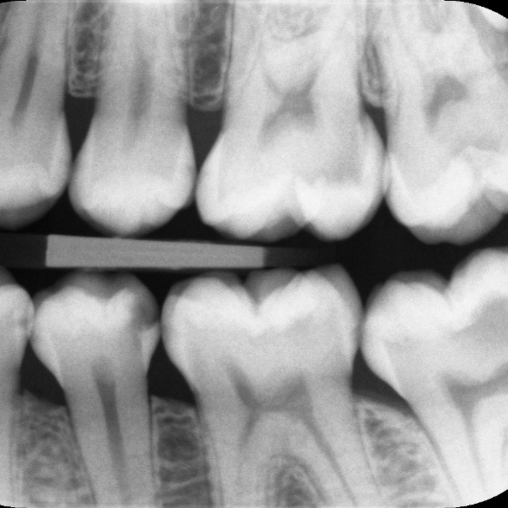 Equipos de Rayos X Intraoral | DentalPro