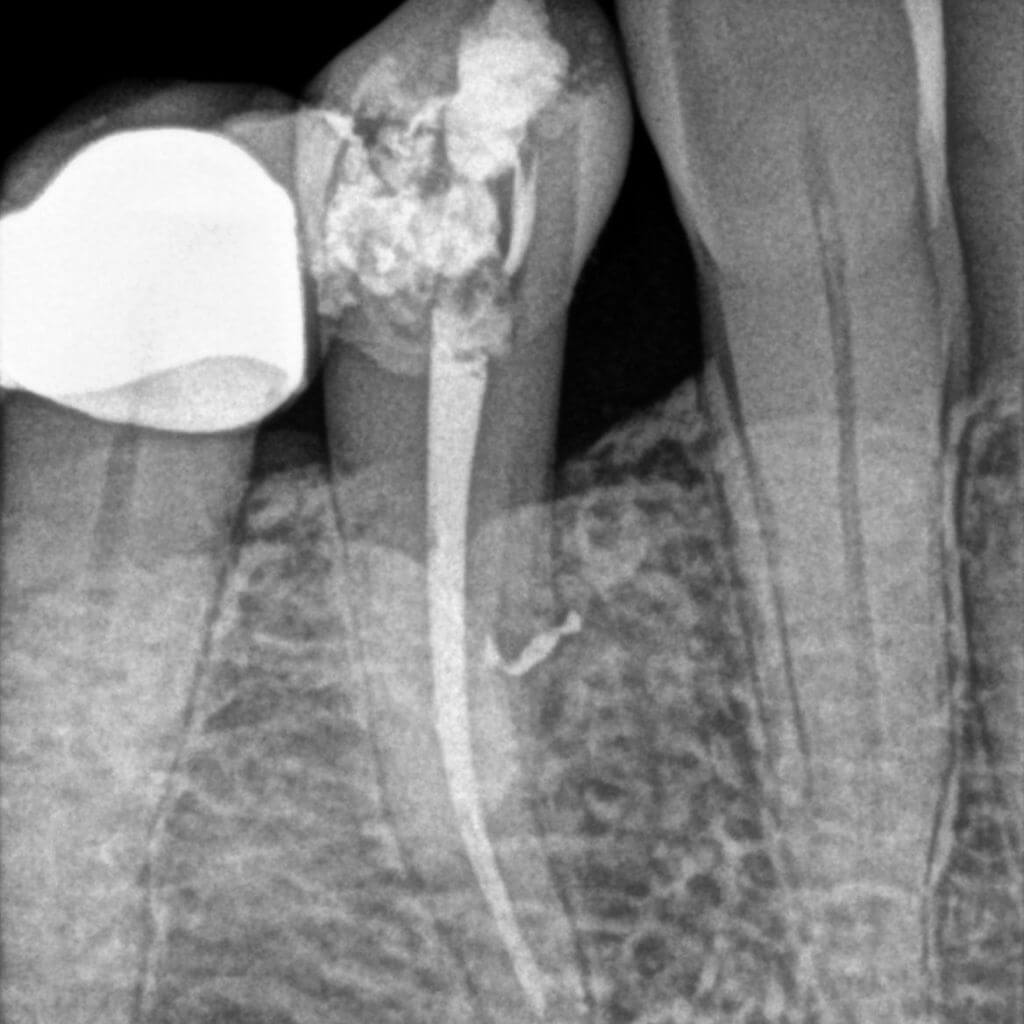 Radiovisiografo RVG Element – Dental Pro